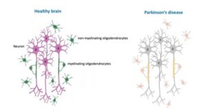 Hidden Ancient RNAs and New Frontiers in Parkinson’s Research: Paving ...